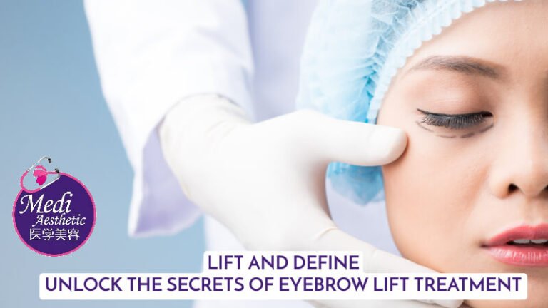 Lift And Define: Unlock The Secrets Of Eyebrow Lift Treatment – Medi ...